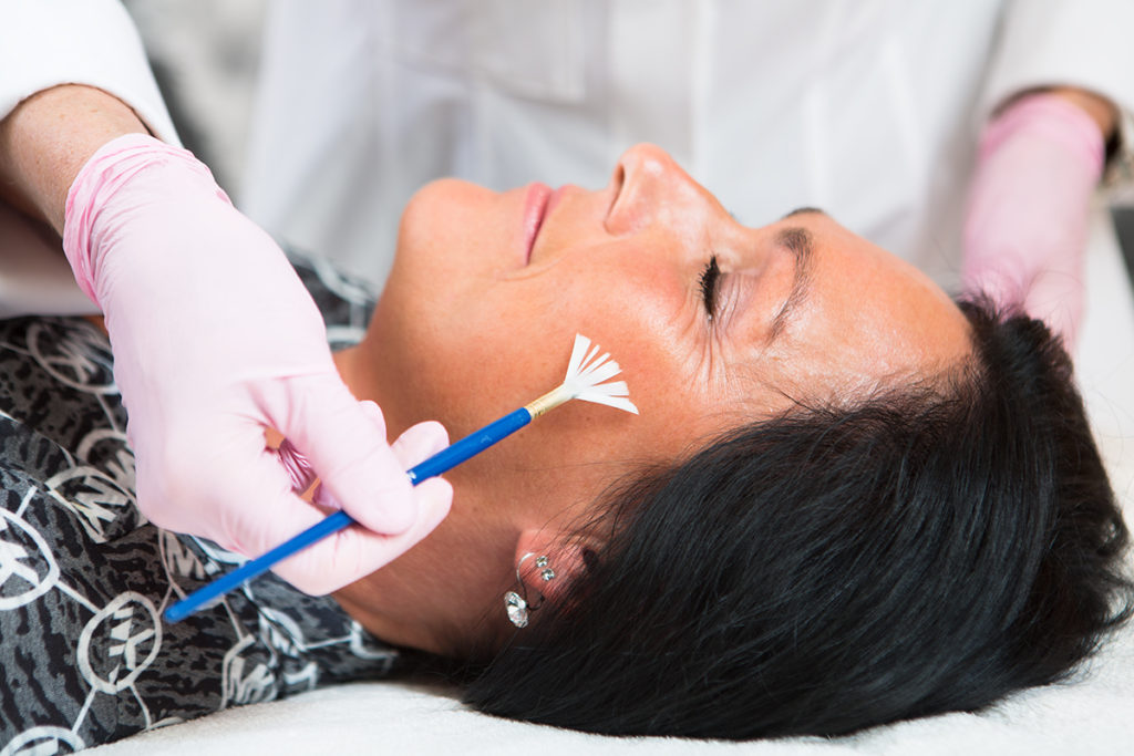 Chemický peeling - obnova pleti Efektivní metoda pro vyhlazení pleti v ...